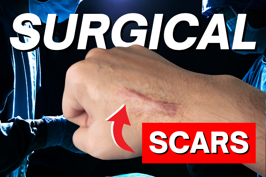 Surgical Scar Care 101: What Doctors Don’t Always Tell You – Lavior