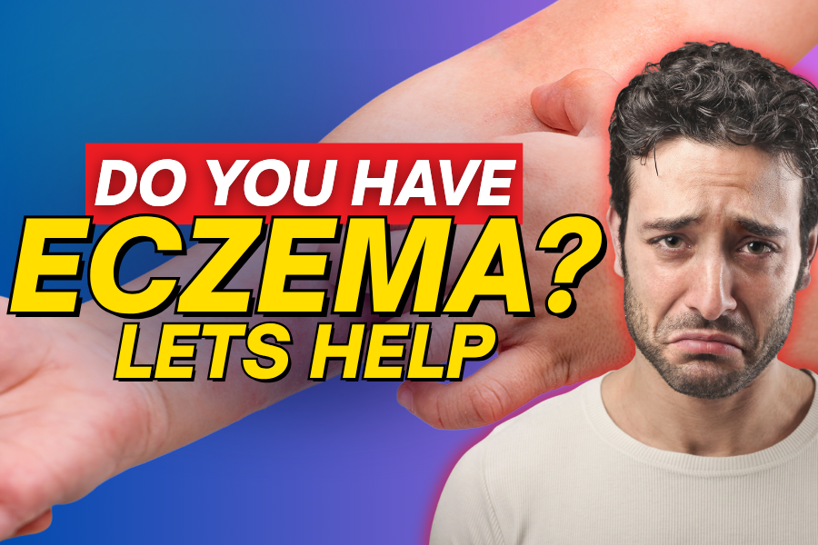 Eczema Flare-Ups? Here's How to Calm the Cycle Naturally – Lavior